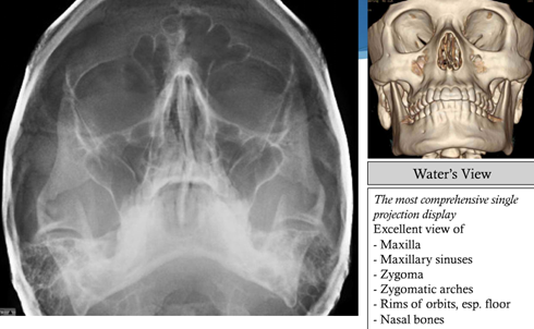 Medicine Decoded: Lines of Dolan and the elephants of Rogers
